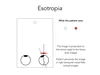 Introduction To Clinical Prisms — Ophthalmology Review