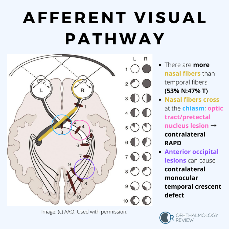 The Afferent Visual Pathway — Ophthalmology Review