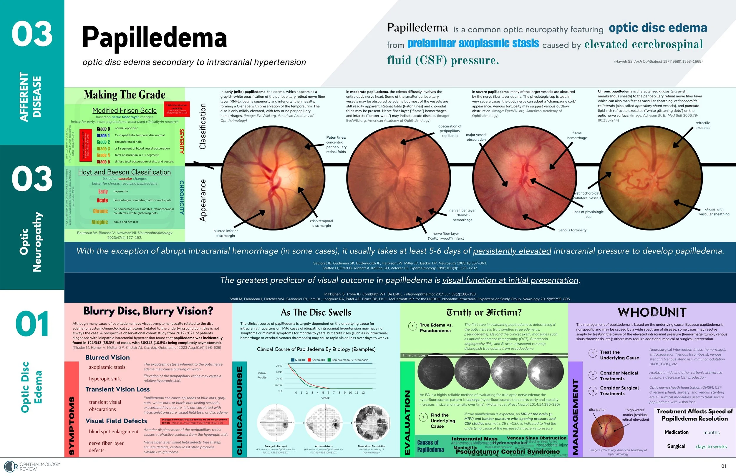 Papilledema Vs Glaucoma