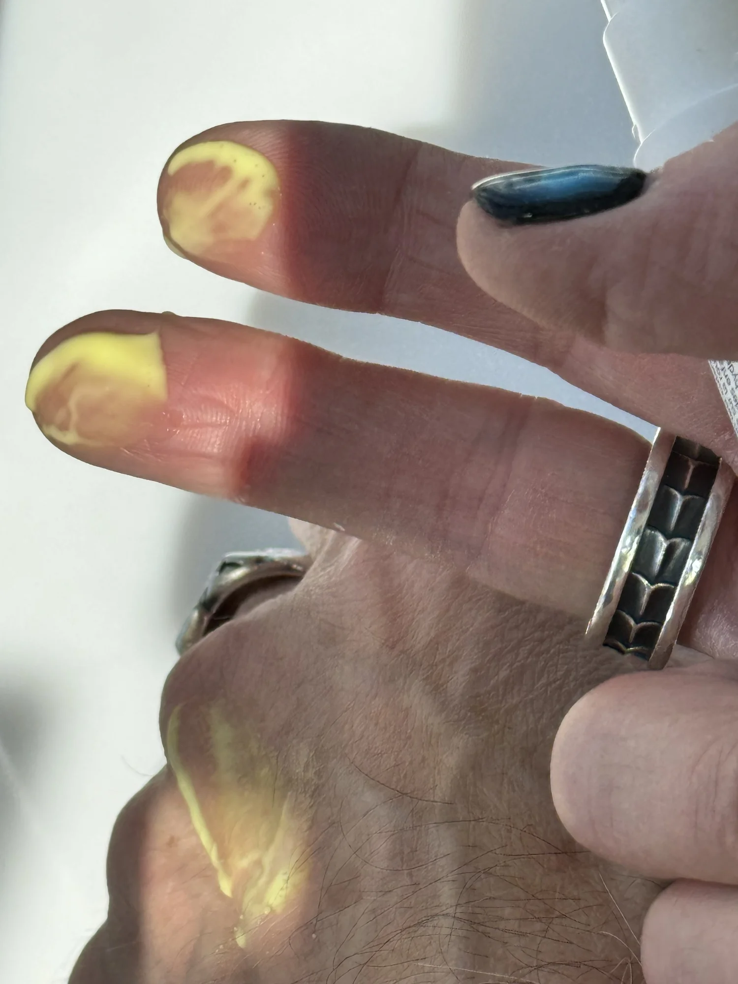 PROS & CONS - THE ORDINARY RETINAL 0.2% EMULSION SERUM PRODUCT REVIEW ...