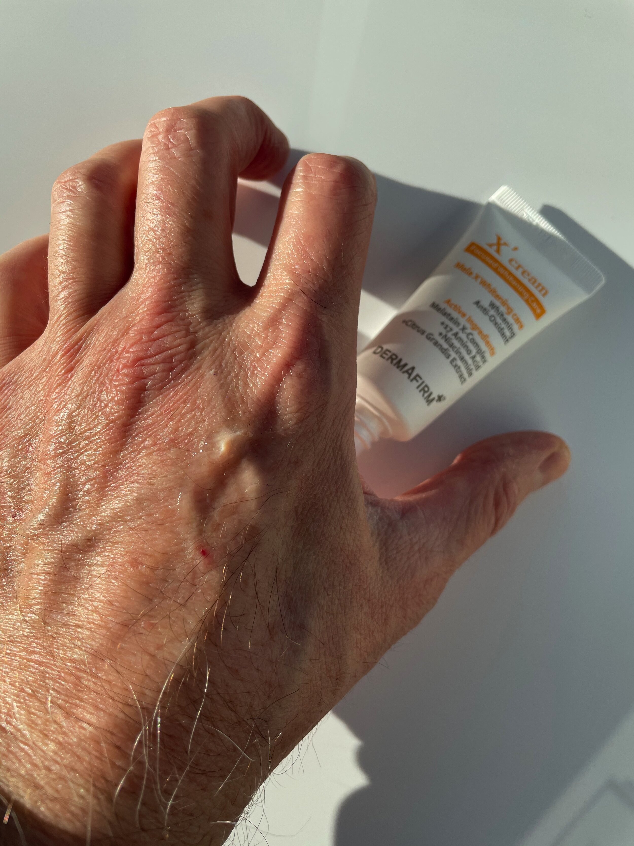 DERMAFIRM X CREAM DARK SPOT TREATMENT - ONE OF THE BEST BRIGHTENING ...