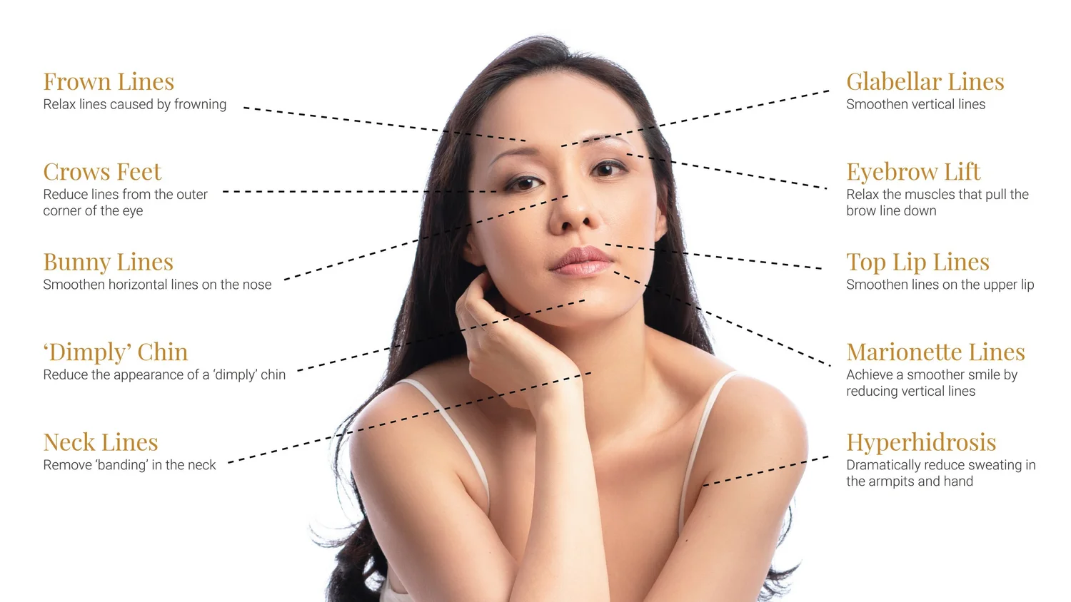 Botulinum Toxin Treatments in Singapore: What to Expect | The Aesthetic ...