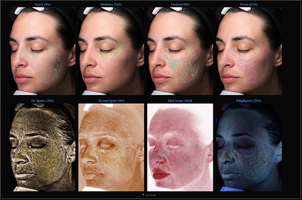 Visia Computerized Facial Analysis — Three Sisters Laser + Medical