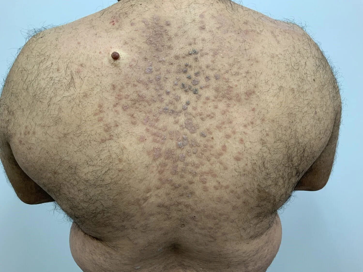 CONTACT US — Twin Cities Dermatology Center