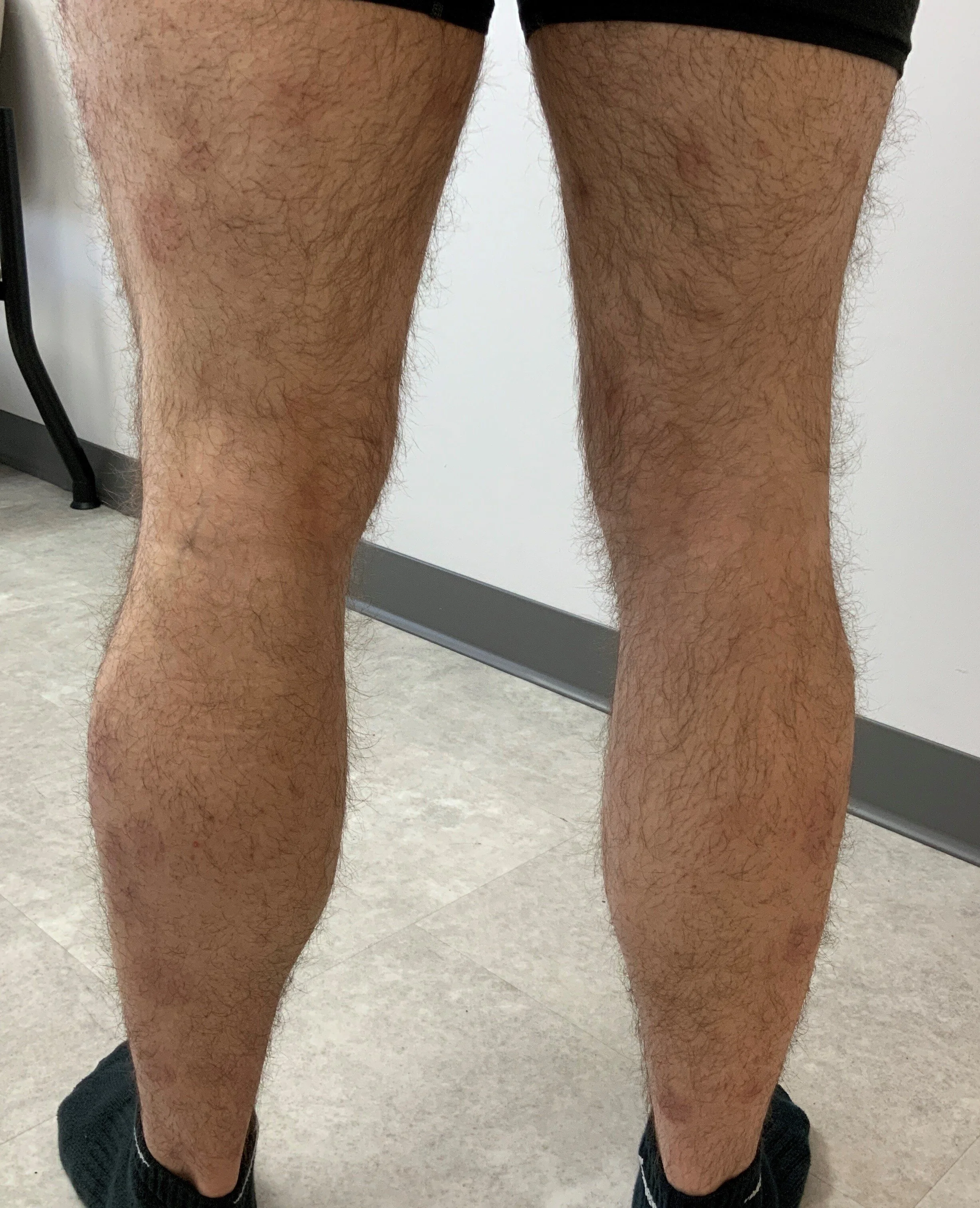 CONTACT US — Twin Cities Dermatology Center