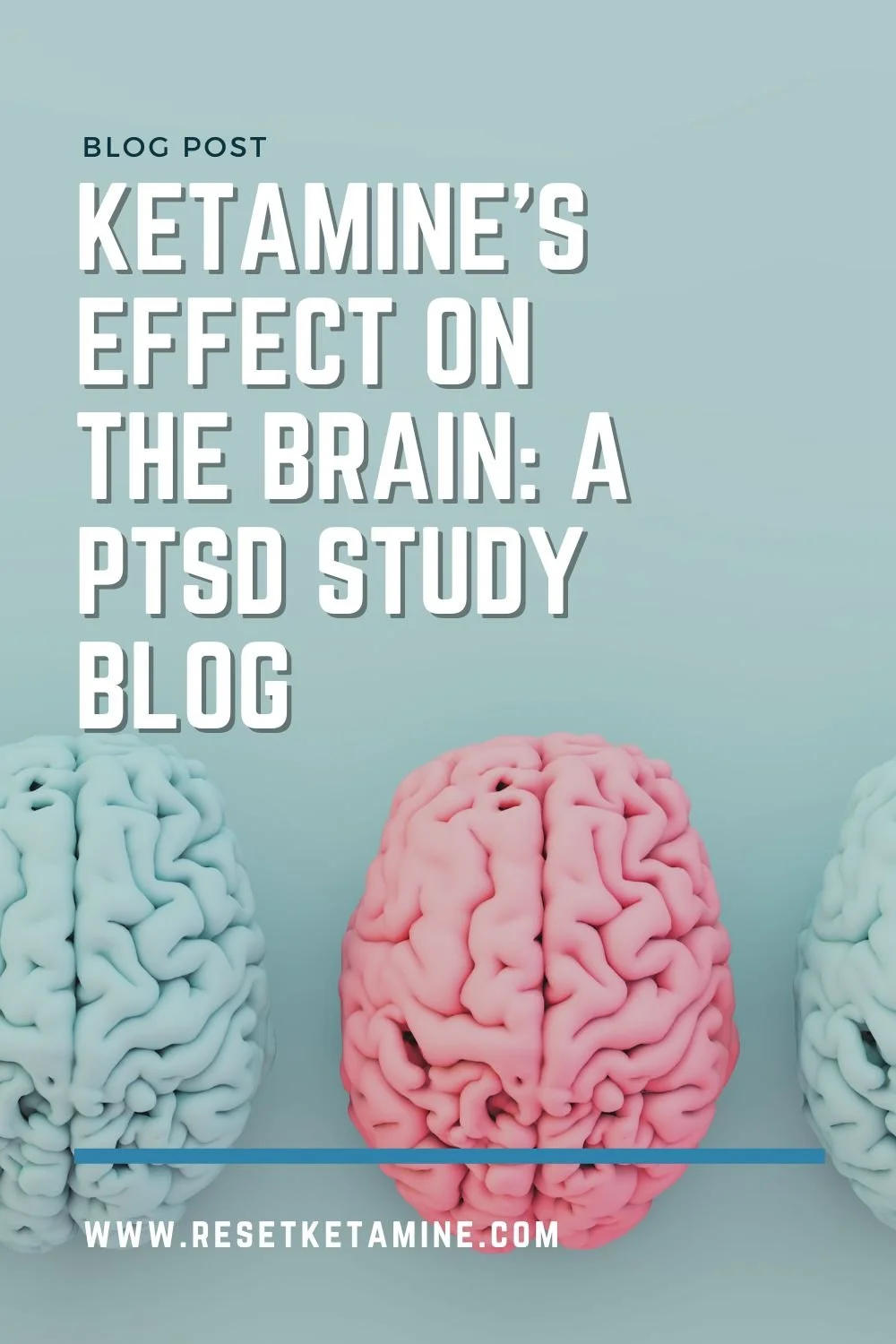 Ketamine's Effect On A Brain With PTSD — Reset Ketamine - Ketamine ...