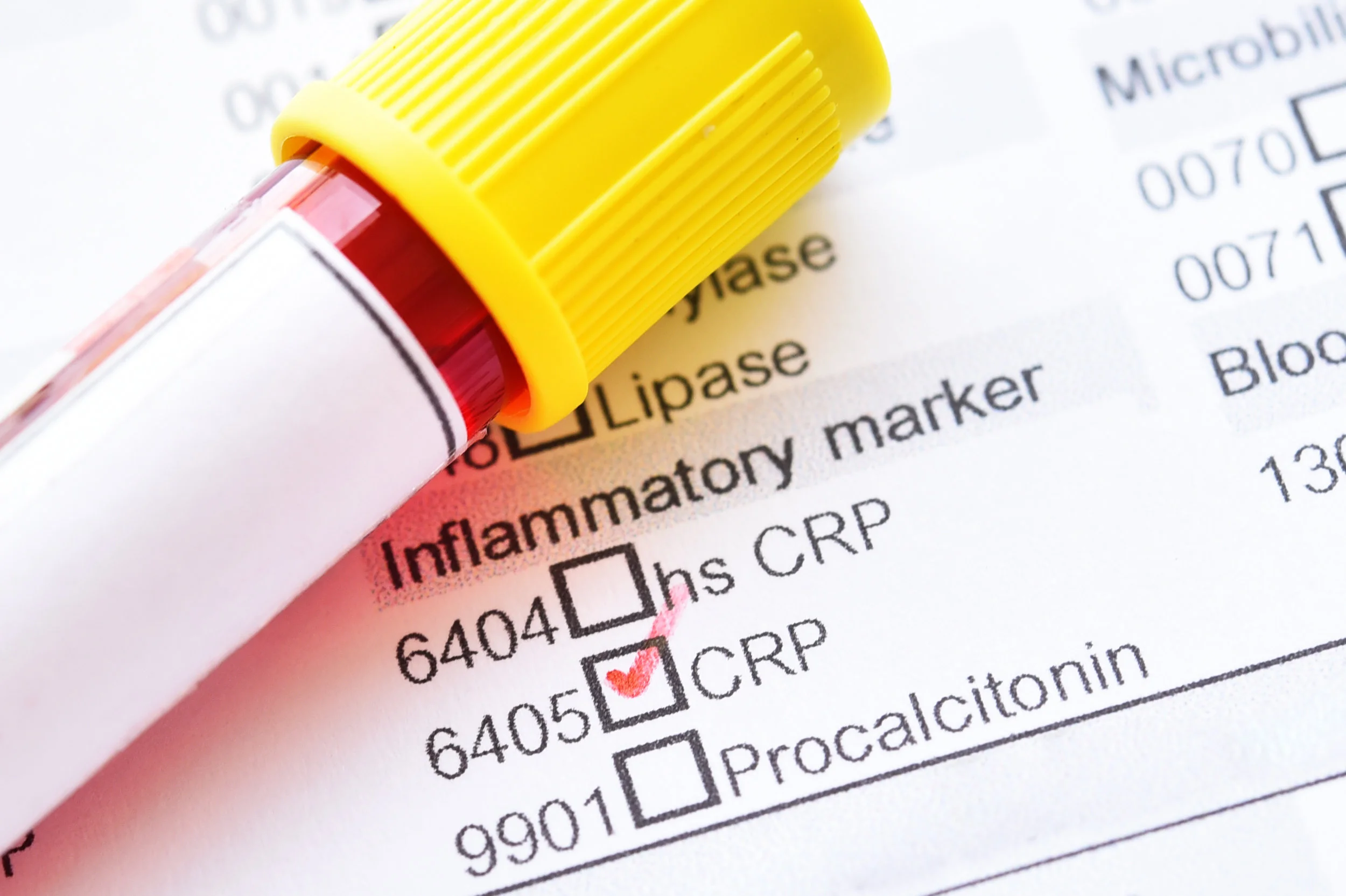 Why I Monitor My CRP Levels Ernie Bray Entrepreneur Author Athlete Why I Monitor My CRP Levels Ernie Bray Entrepreneur Author Athlete