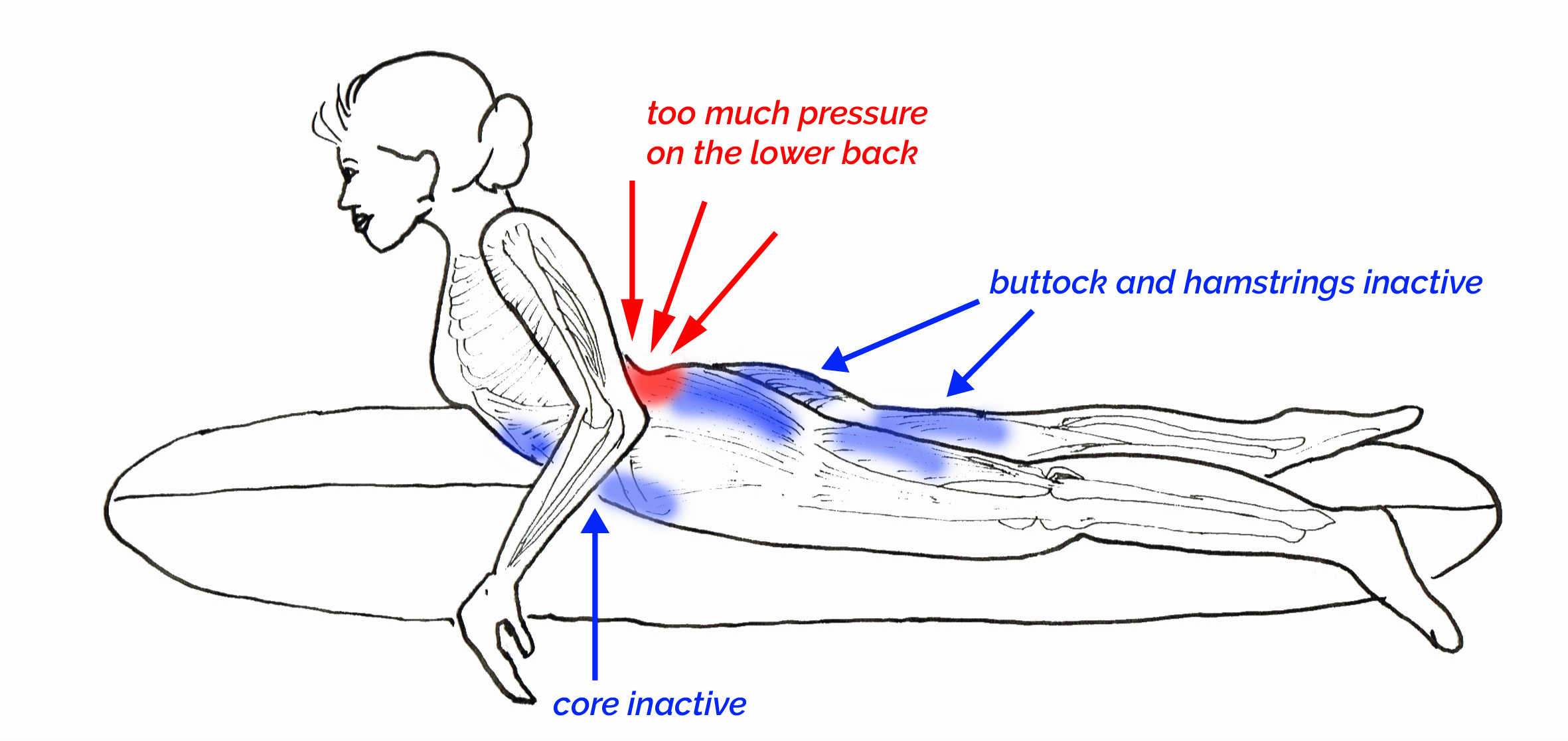 Lower back pain during surfing — Sweat Tears and the Surf