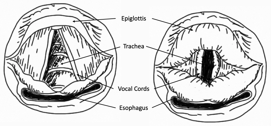 Normal Larynx