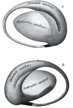 What Is The Structure And Function Of The Lentiform Nucleus Brain Stuff What Is The Structure And Function Of The Lentiform Nucleus Brain Stuff