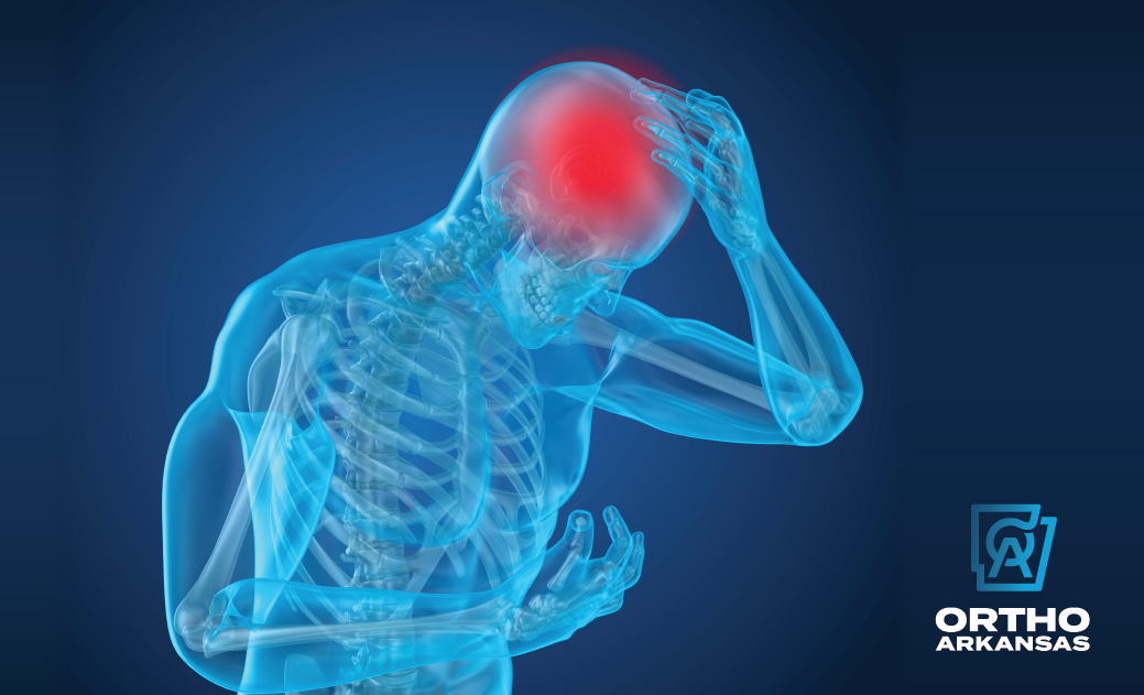 Keep your head in the game: How to spot a concussion — OrthoArkansas