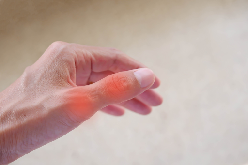 What Causes Pain In The Thumb? - Melbourne Physio Clinic & Fitness ...