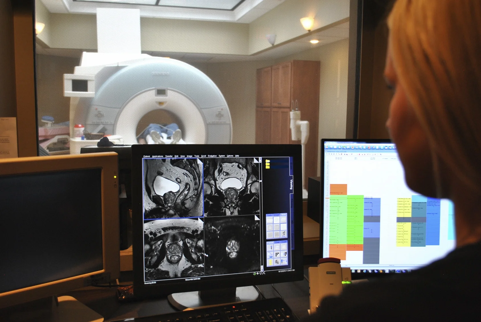 Prostate MRI — PrimeImaging