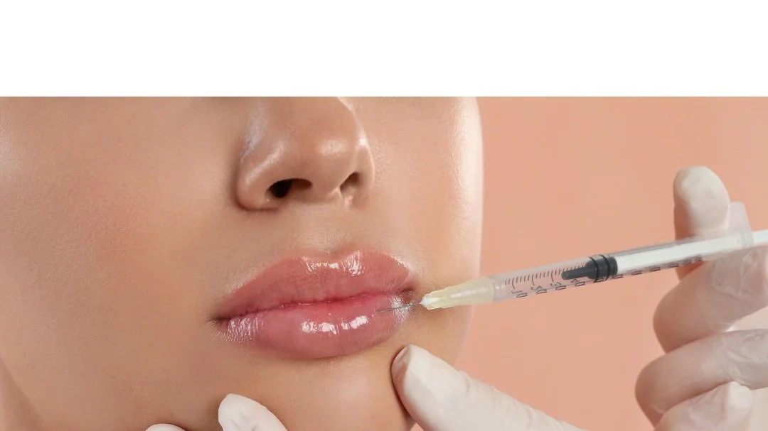Lip Fillers London - Premium Lip Enhancement | Kensington Skincare ...