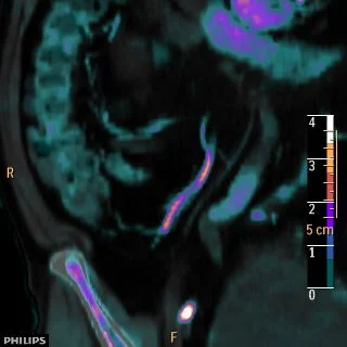 Goblet, anyone? — Spectral CT