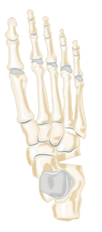 Evans Osteotomy Procedure — REIGN MEDICAL