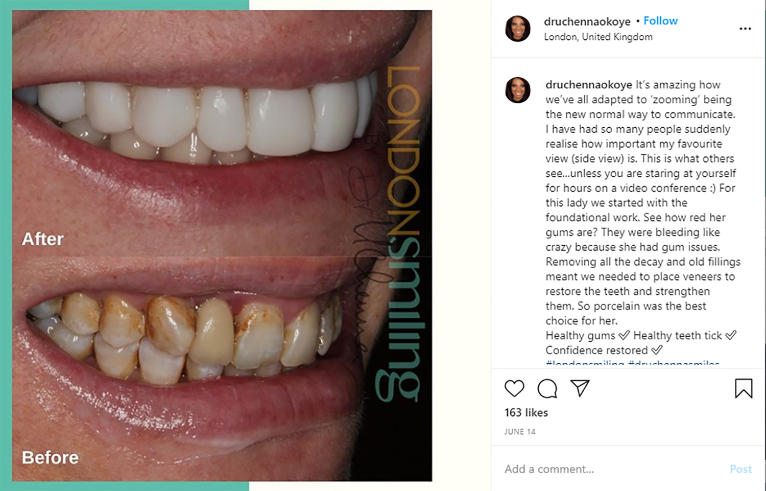 Instagram for Doctors: Where to Start and How to Succeed — Etactics