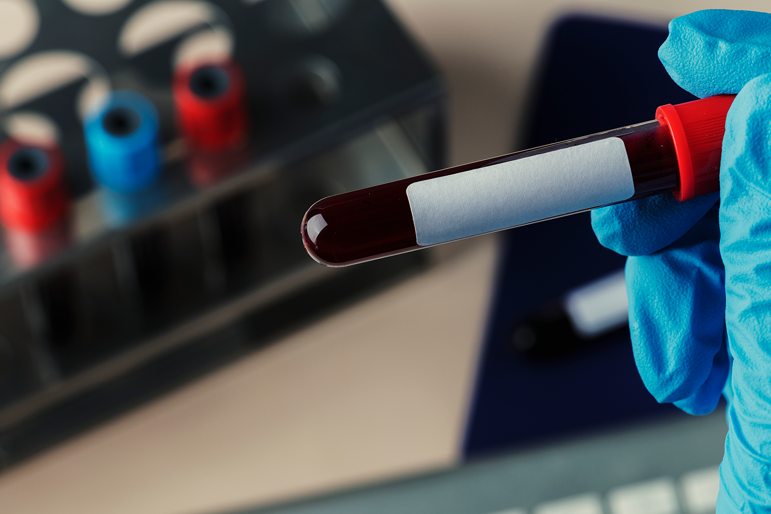 40+ Workplace Bloodborne Pathogens Quiz Questions — Etactics