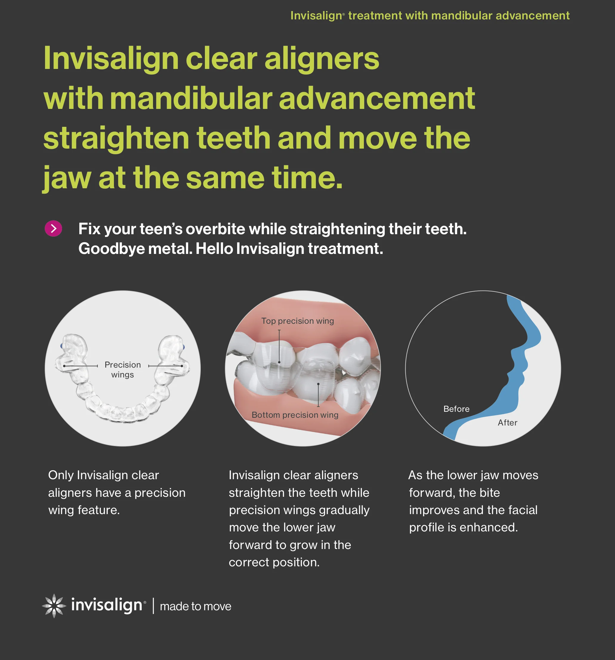 Invisalign Tri Cities — Angus Square Dental