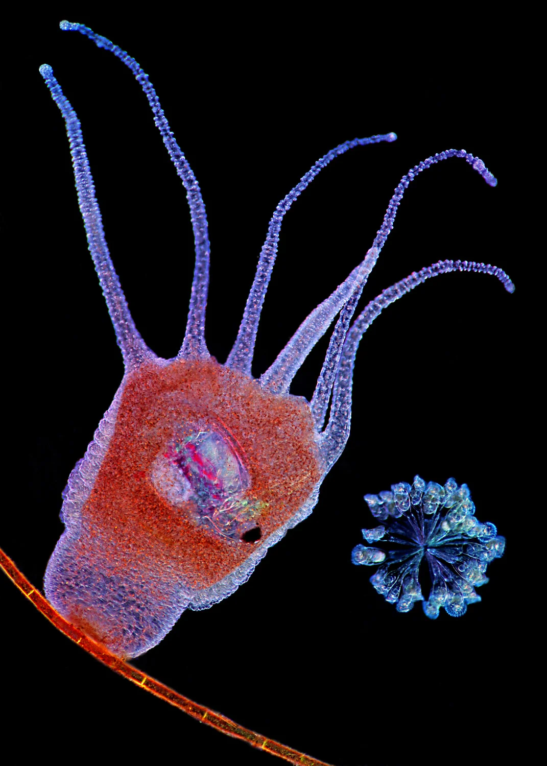 Hydra Under Microscope