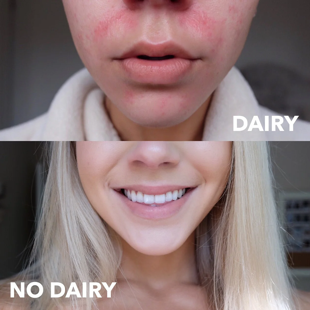 How does Dairy effect your skin? — Catherine Faraday