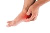 Why Your Feet Are Red - Four Possible Causes — Westfield Foot and Ankle ...