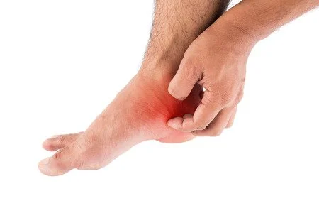 Why Your Feet Are Red - Four Possible Causes — Westfield Foot and Ankle ...