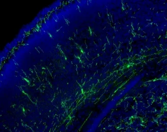 The Embryonic Specification of Interneurons — The Fishell Laboratory