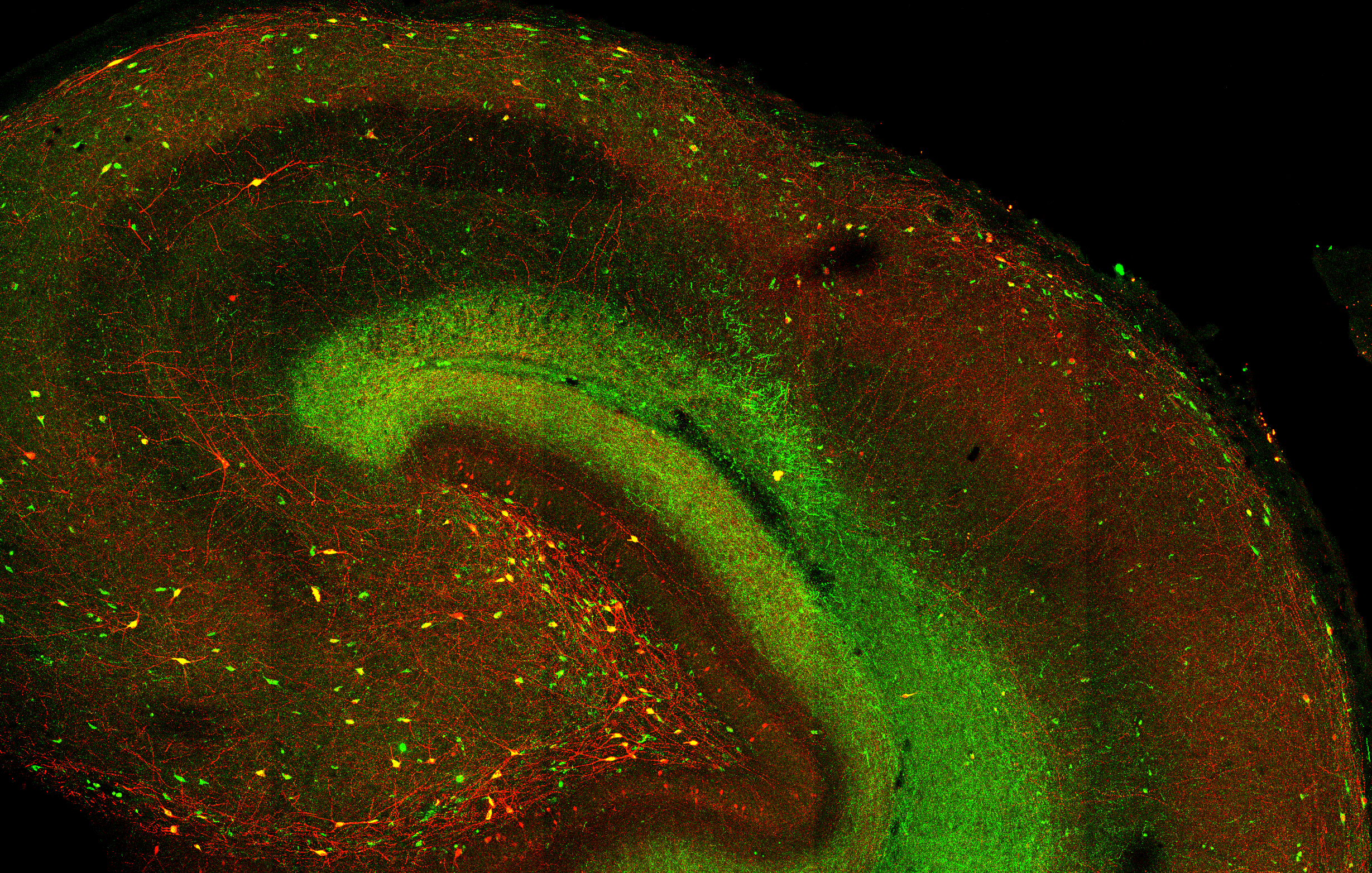Interneuron Function and Dysfunction — The Fishell Laboratory