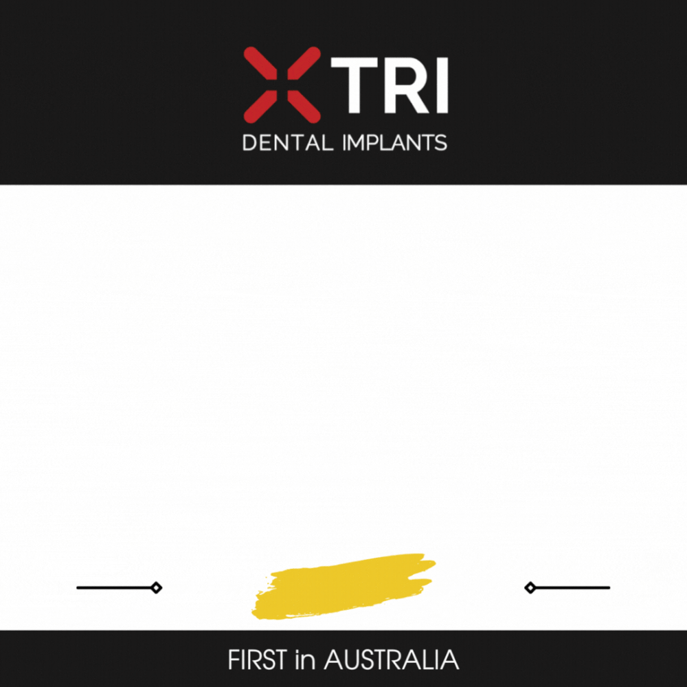 Tri Dental Implants Australia — ADELAIDE LABORATORIES