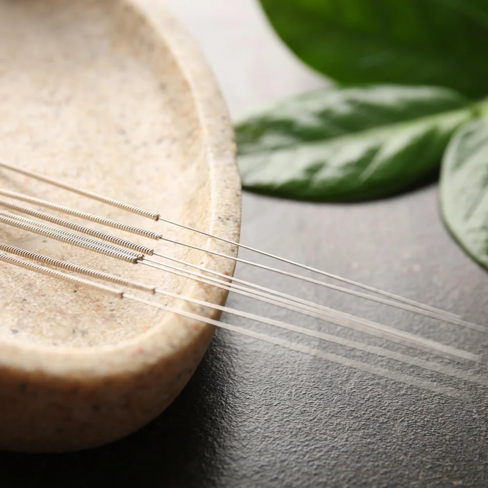 How Acupuncture Works and How Does it Help?