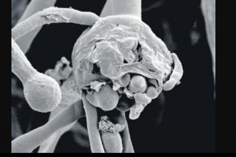 Mucormycosis Or Black Fungus Infection- Causes and Symptoms — Medipulse ...