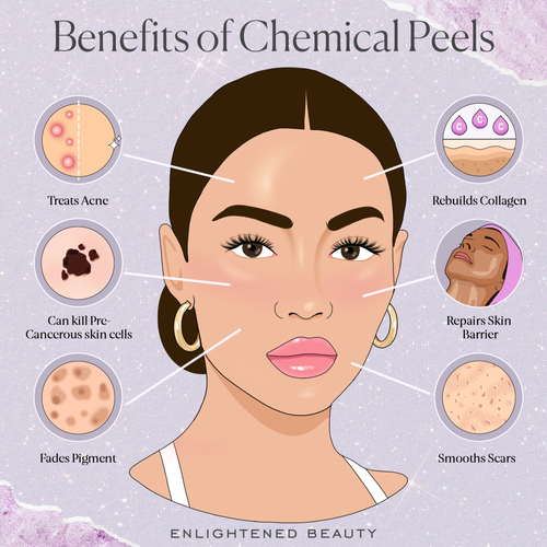 Benefits of Chemical Peels — Enlightened Beauty by Morgan Elizabeth