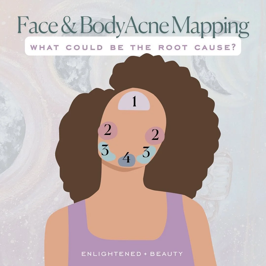 Can You Treat Puberty Acne? 4 Reasons To Start Your Preteen's Treatment ...