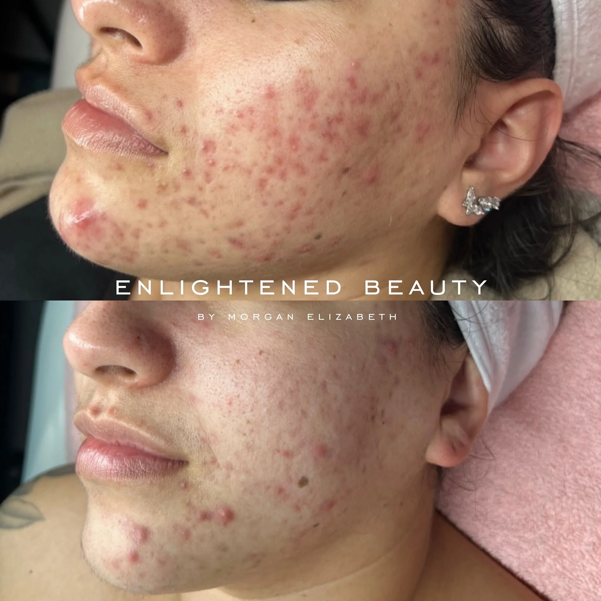 Breaking Down Our Most Popular Treatments In Our Esthetics Business ...