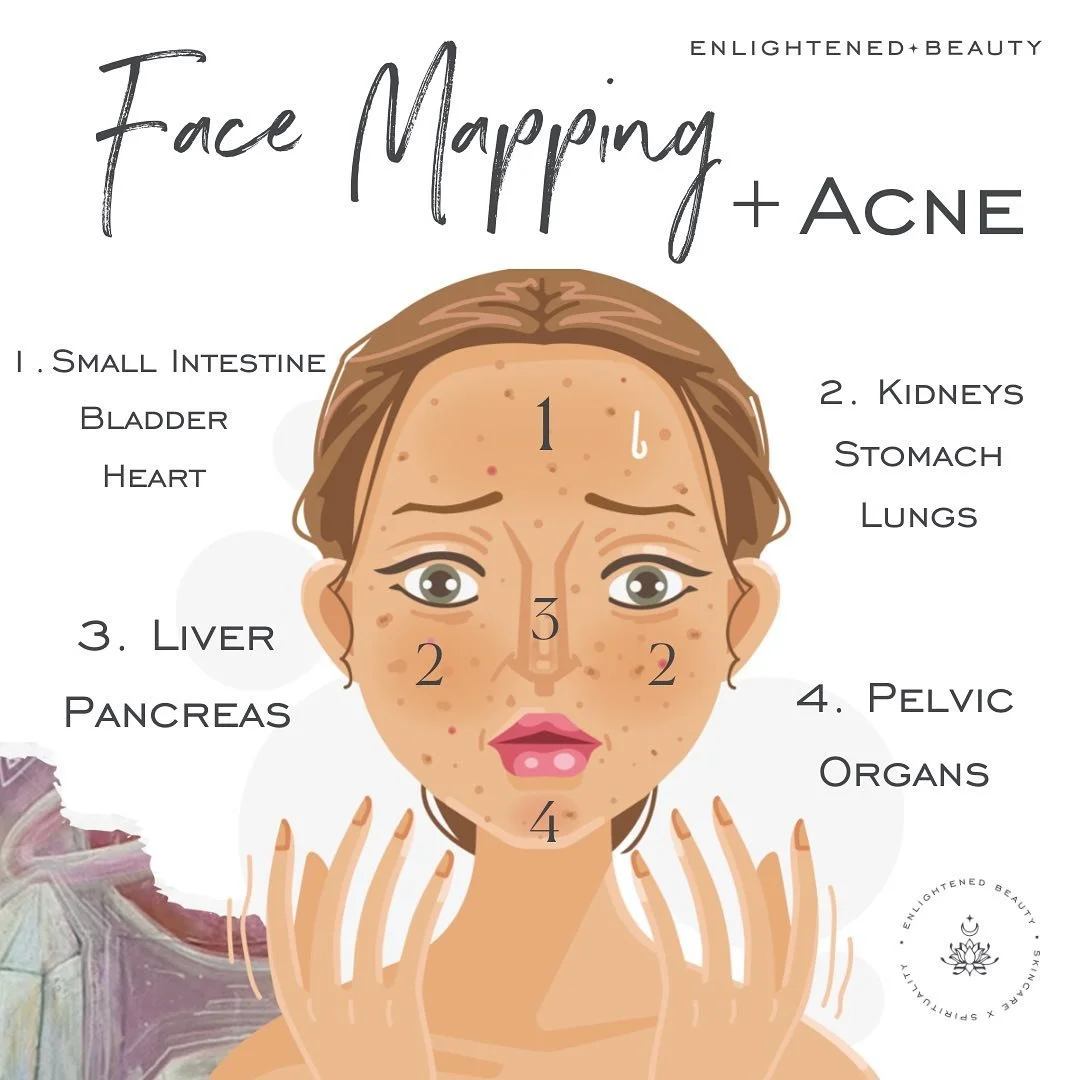 Face Mapping For Acne Enlightened Beauty By Morgan Elizabeth Face Mapping For Acne Enlightened Beauty By Morgan Elizabeth