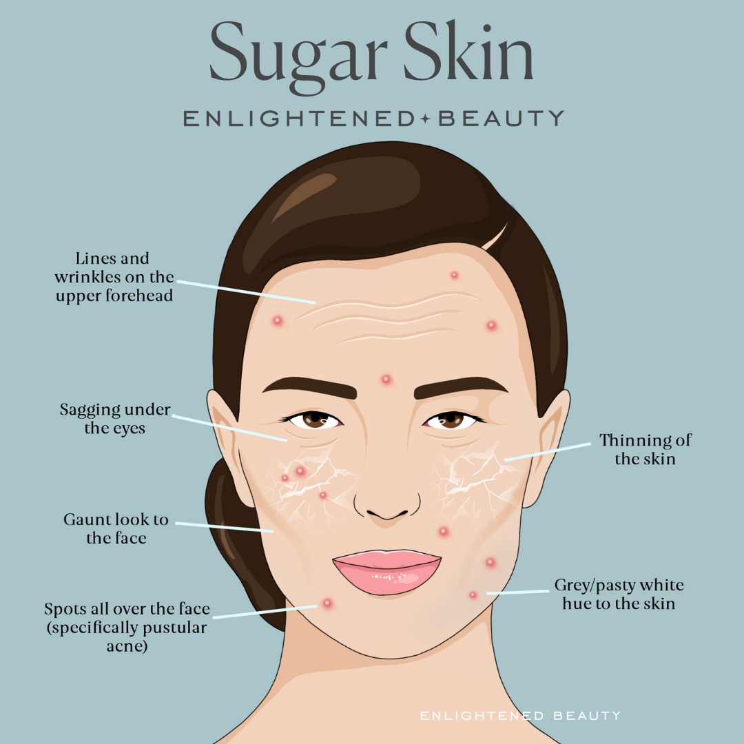 Acne Face Mapping: Understanding the Link Between Your Organs and Your ...