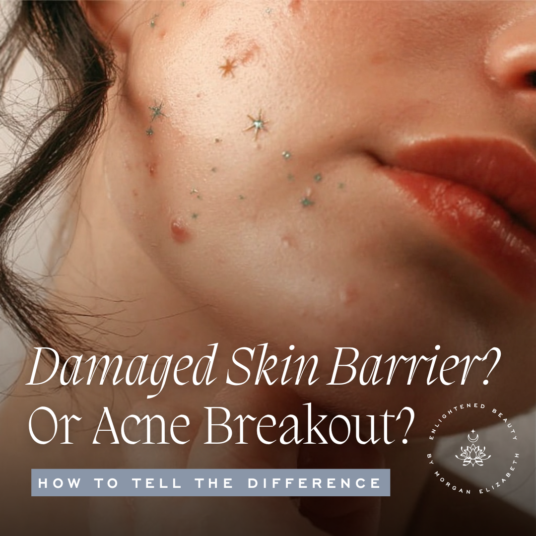 Is Your Skin Barrier Damaged, Or Are You Just Breaking Out ...