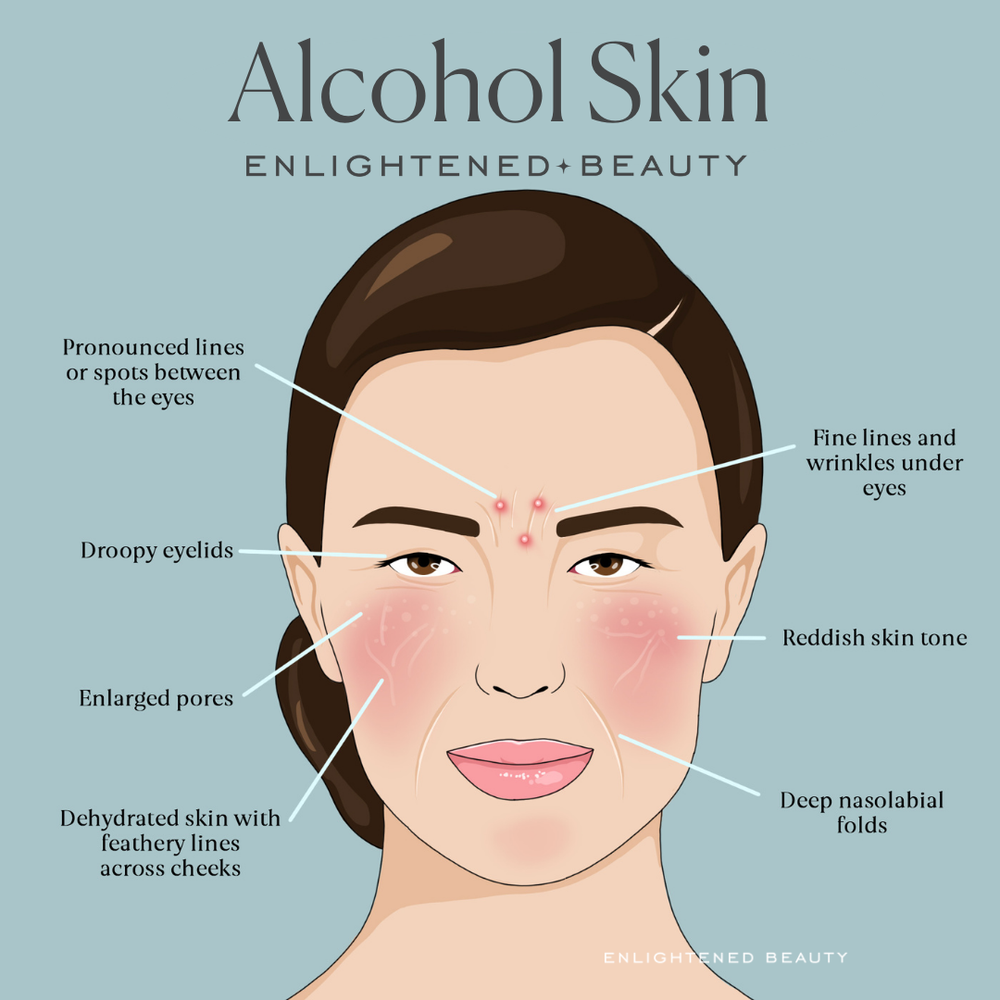 Acne Face Mapping: Understanding the Link Between Your Organs and Your ...