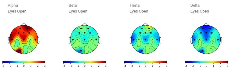 Neurofeedback | Cuyahoga Falls & Greater Akron, OH — Alternative ...
