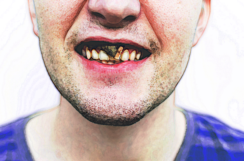 Chewing Tobacco Cancer Chewing Tobacco Cancer