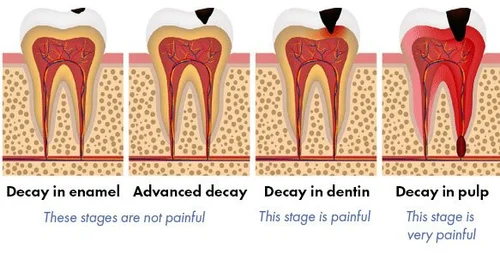 3 Commonly Confused Dental Terms — Alexandria Smiles
