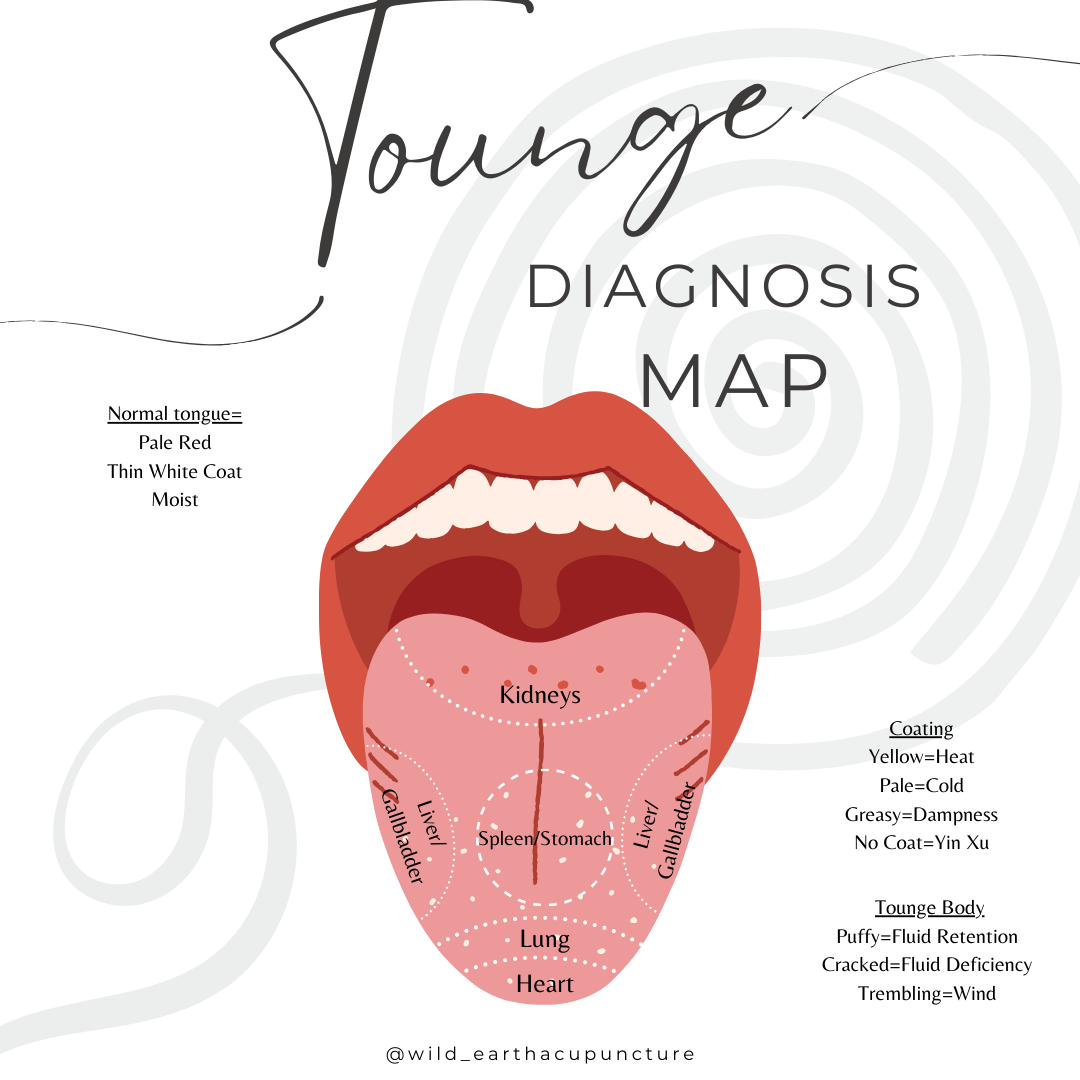 Tongue Diagnosis In Chinese Medicine — Wild Earth Acupuncture ...
