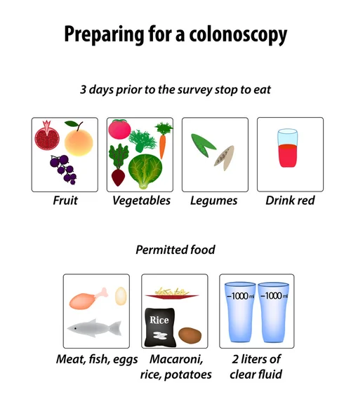 Preparing for Colonoscopy- Steps to Be Taken
