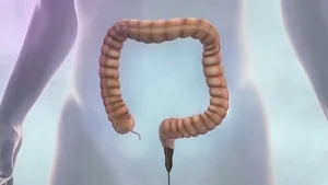 3 Most Common Digestive Problems Often Seen by GI Specialists