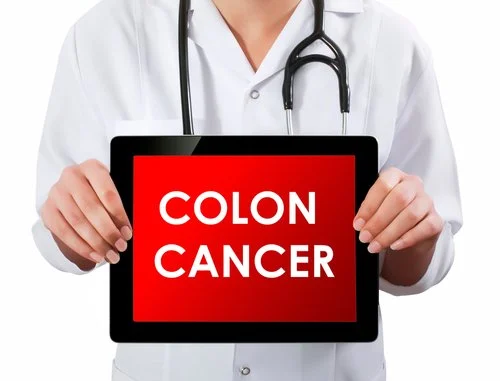 High Time – You MUST Know About Colonoscopy Screening