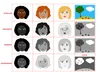 B&W FIlm Types - Ortho / Orthopan / Panchro / Superpanchromatic — Lina ...