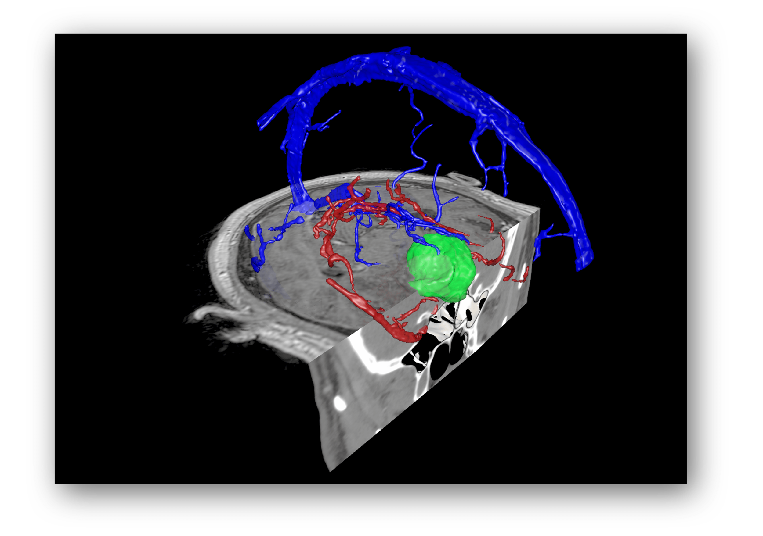 ImmersiveTouch® — Medical VR Solutions