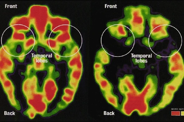 Brain Development — Leelanau Early Childhood Development Commission