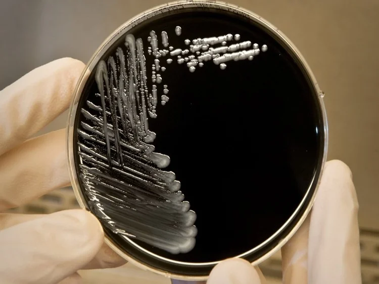 Legionella Testing & Inspection | MSE Environmental